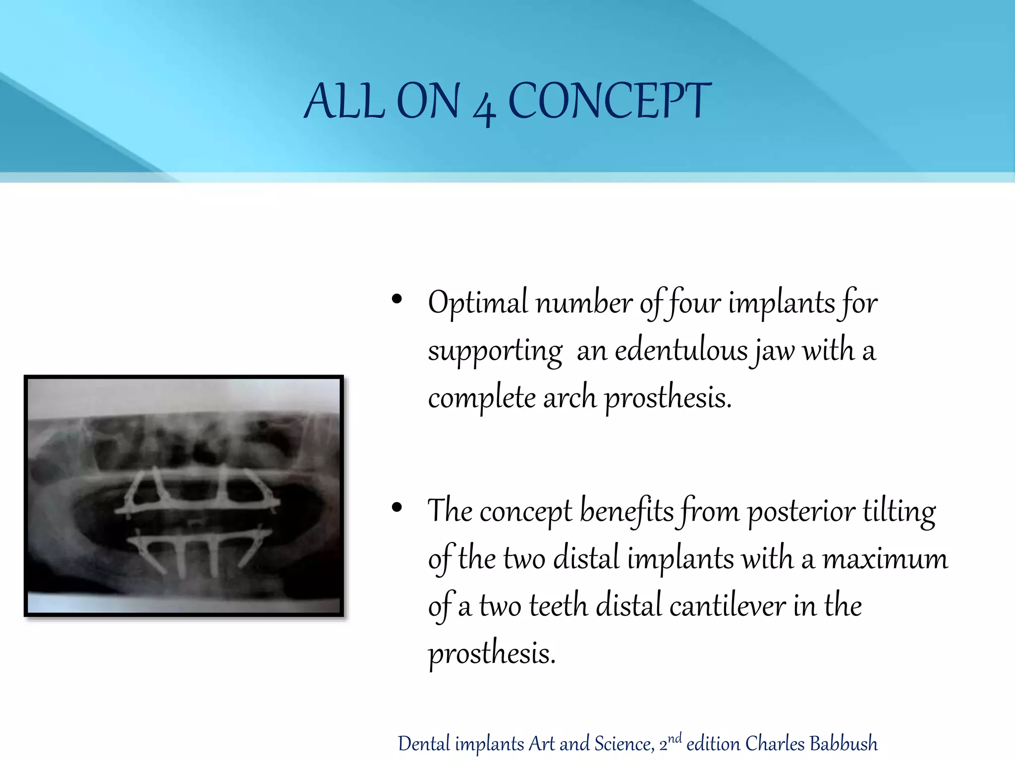 Implant supported overdentures | PPTX