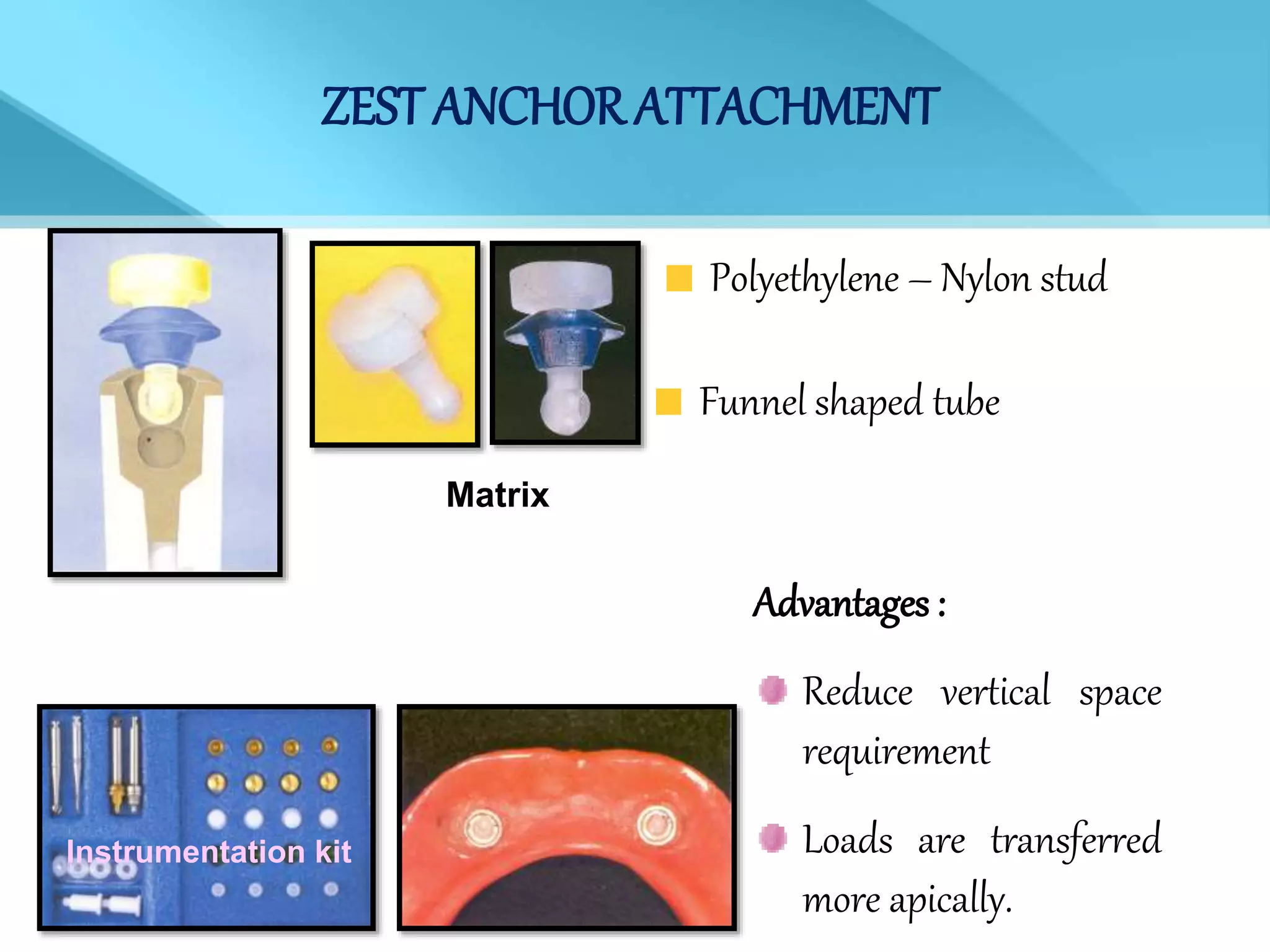 Implant supported overdentures | PPTX