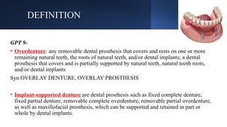 Implant Supported Overdentures final.pptx