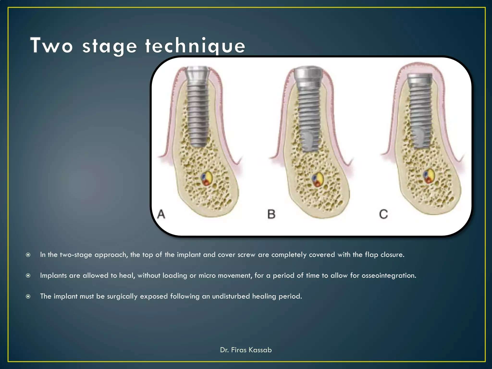 Implant surgical procedure | PDF