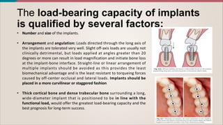 IMPLANT TREATMENT: basic concepts & Techniques.pdf