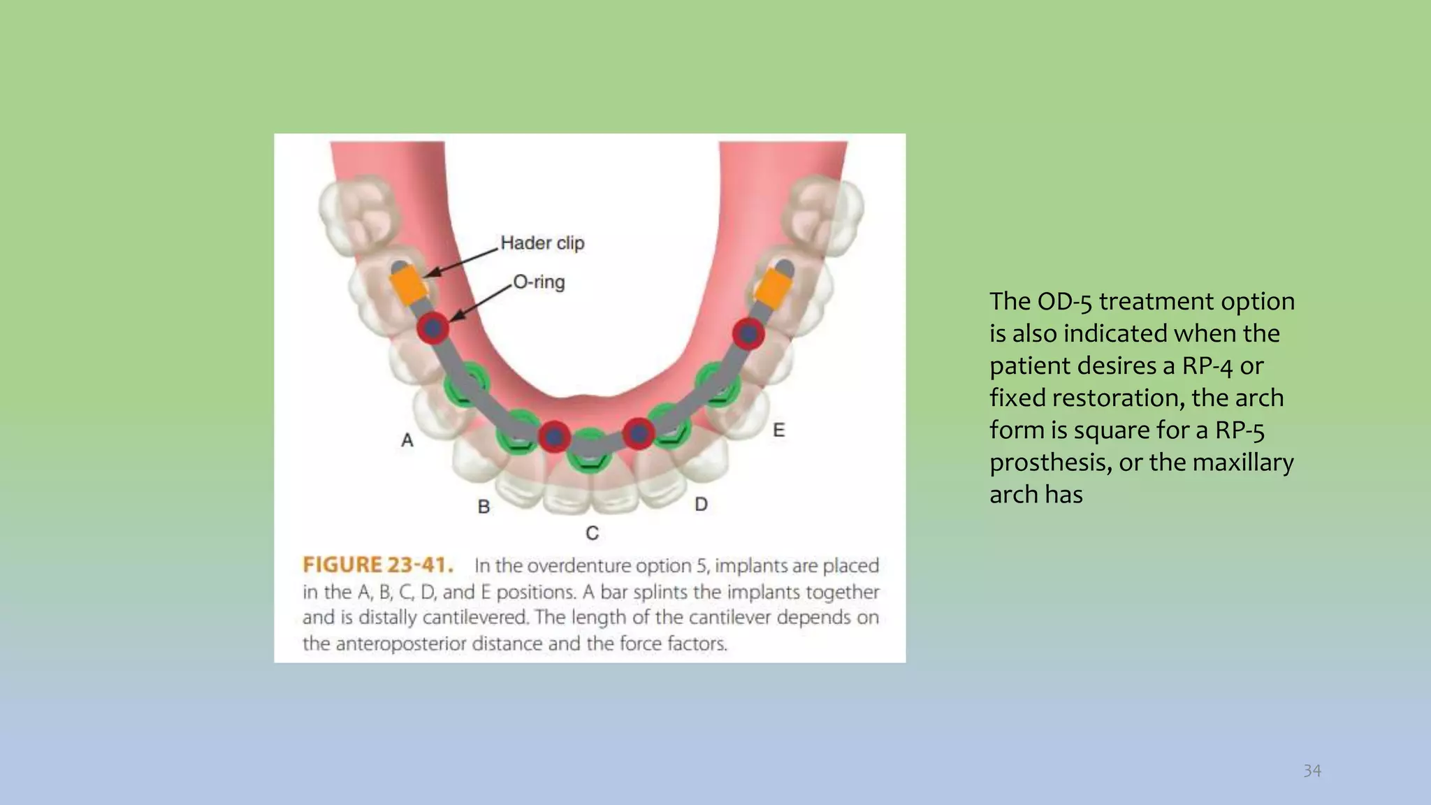 Implant treatment plan for completely edentulous patient | PPTX