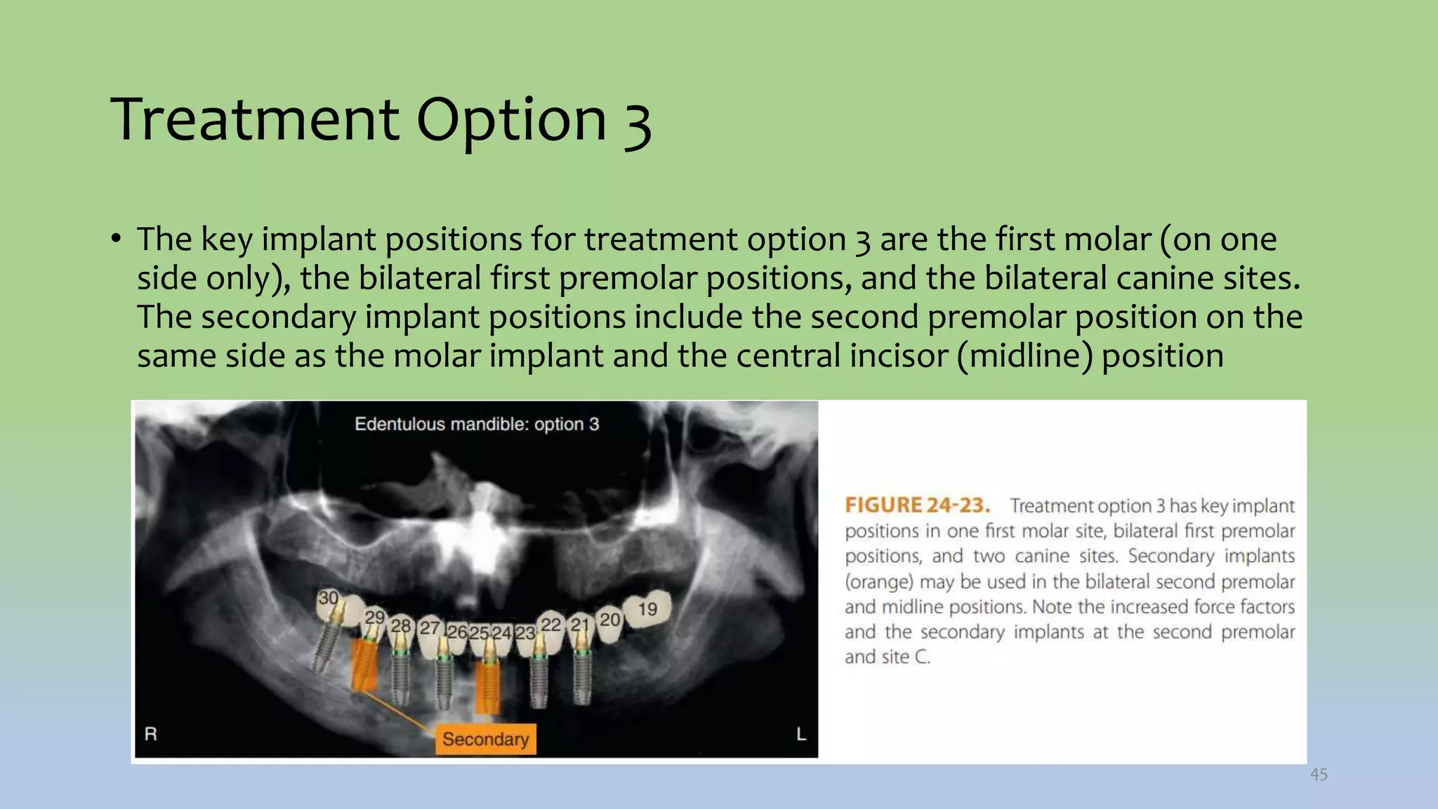 Implant treatment plan for completely edentulous patient | PPTX
