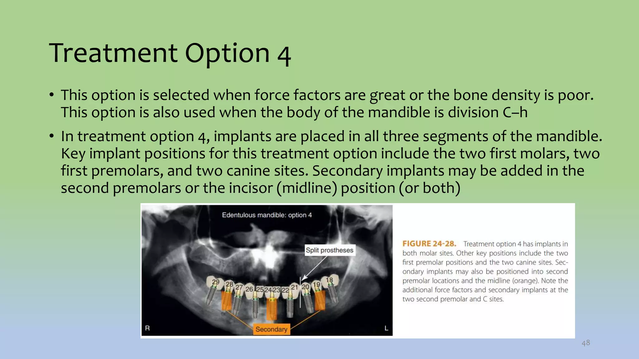 Implant treatment plan for completely edentulous patient | PPTX