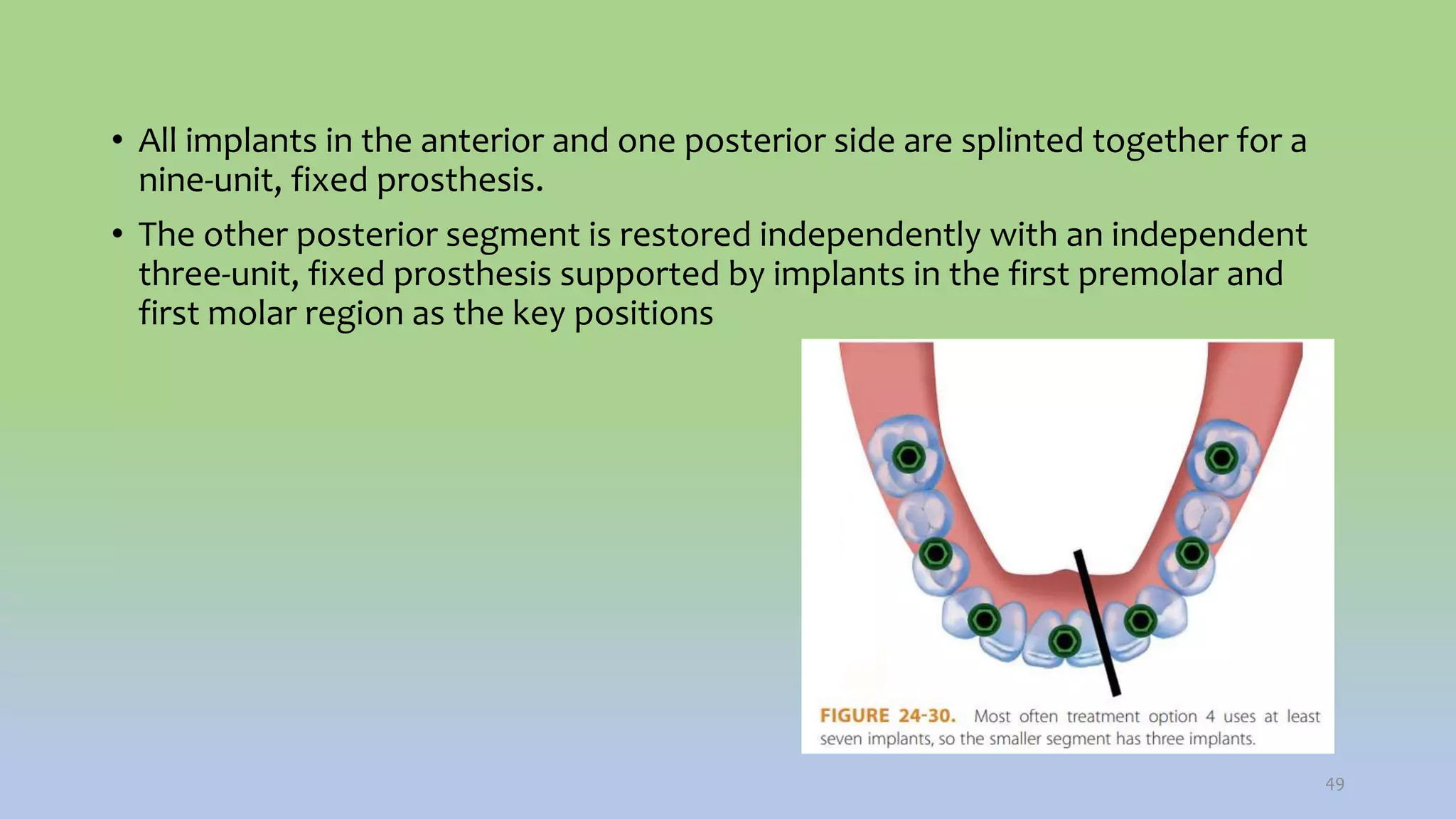 Implant treatment plan for completely edentulous patient | PPTX