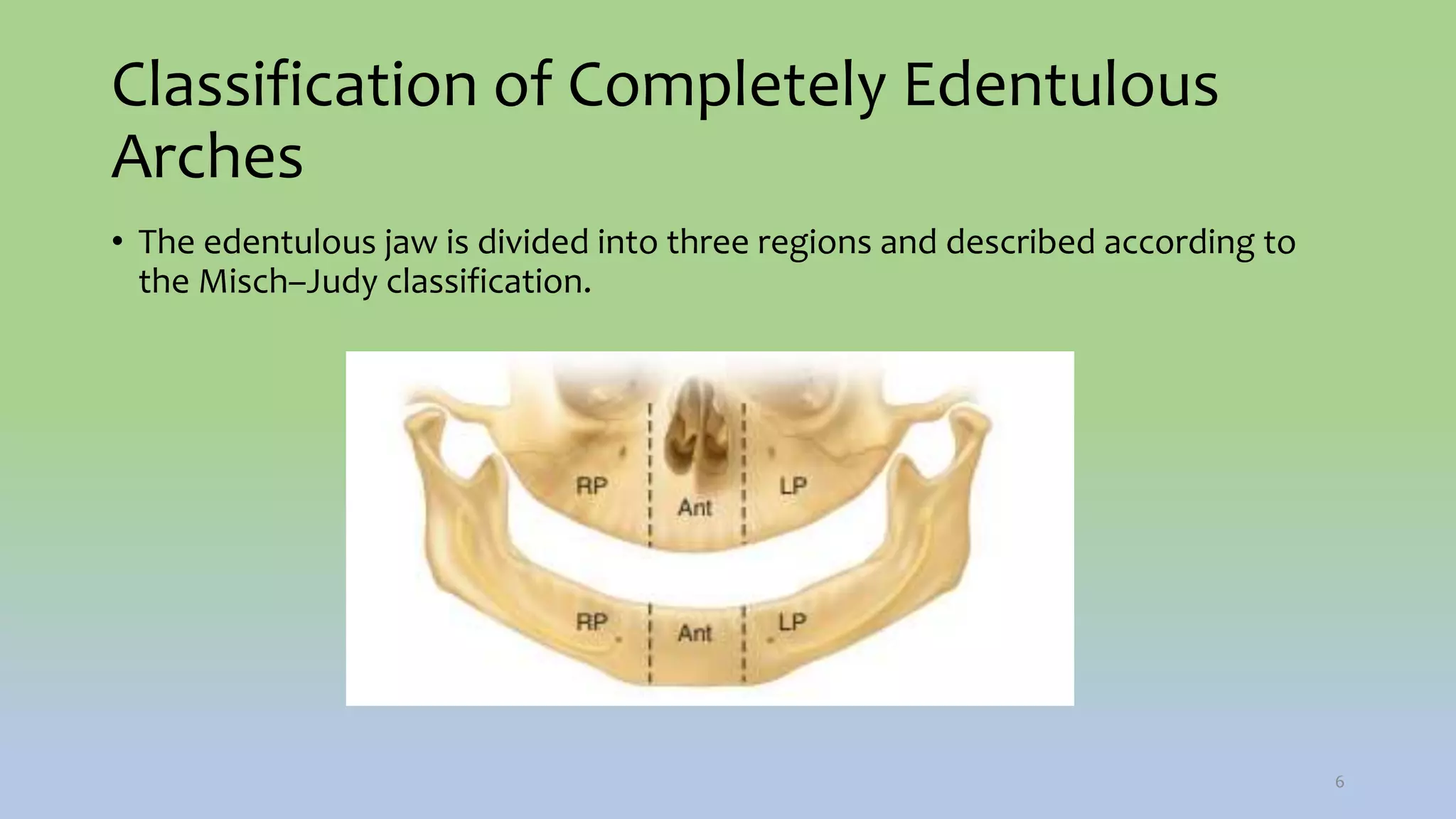 Implant treatment plan for completely edentulous patient | PPTX