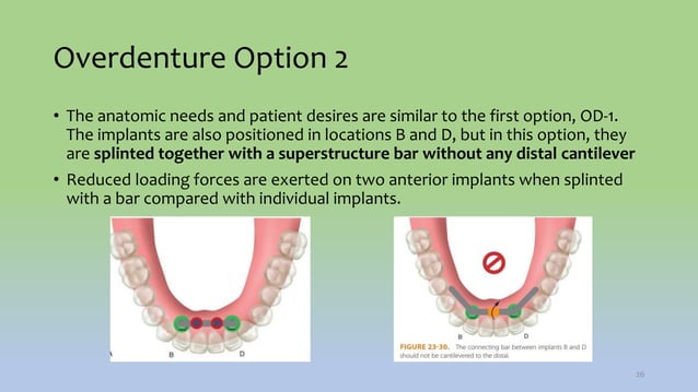Implant treatment plan for completely edentulous patient | PPTX