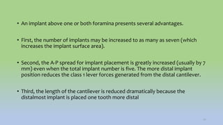 Implant treatment plan for completely edentulous patient | PPTX