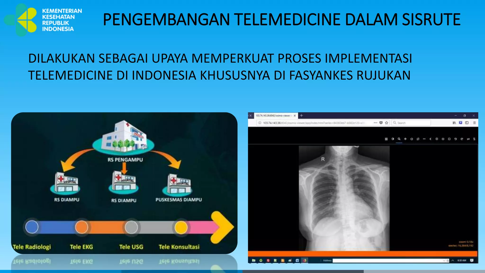 Implementasi Telemedicine di Indonesia | PDF