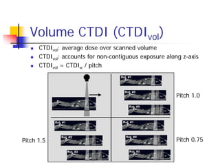 Implementation of an audit and dose reduction program for ct matyagin | PPT