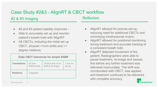 Implementing an End-to-End SGRT Workflow for Breath-Hold SABR | PDF