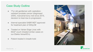 Implementing an End-to-End SGRT Workflow for Breath-Hold SABR | PDF
