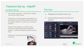 Implementing an End-to-End SGRT Workflow for Breath-Hold SABR | PDF
