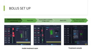 Implementing a novel breast workflow utilising 6DoF through AlignRT ...