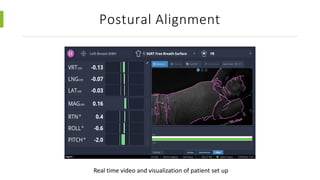 Implementing a novel breast workflow utilising 6DoF through AlignRT ...