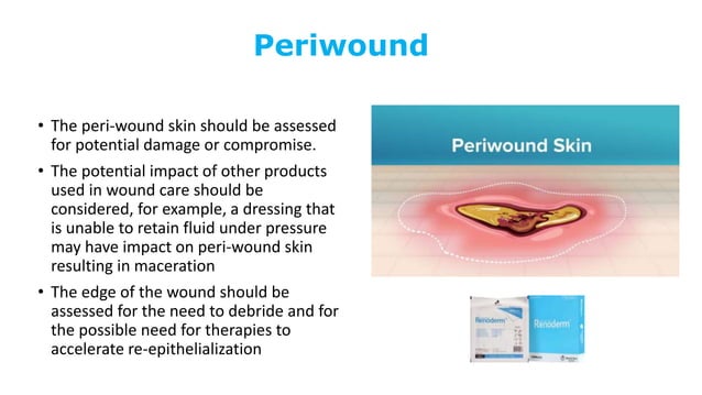 Implementing TIMERS Concept in Real Practice for Hard to Heal Wound ...