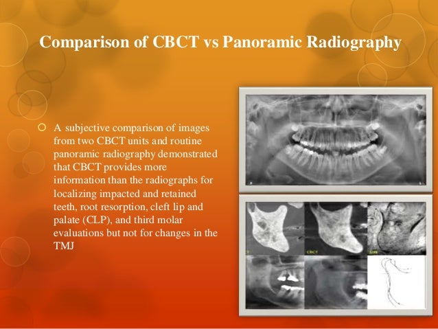 Implications of cbct in orthodontics