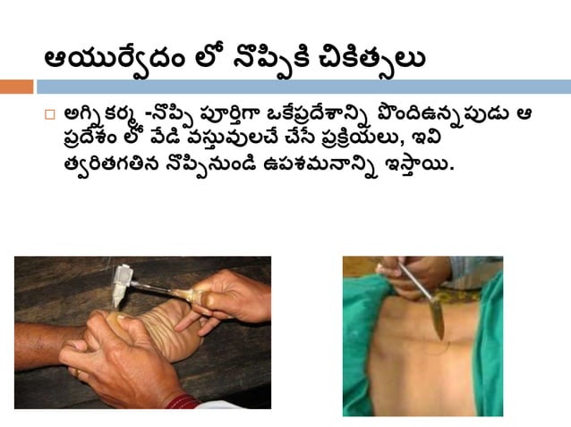 Importance of ayurveda in pain management | PPT