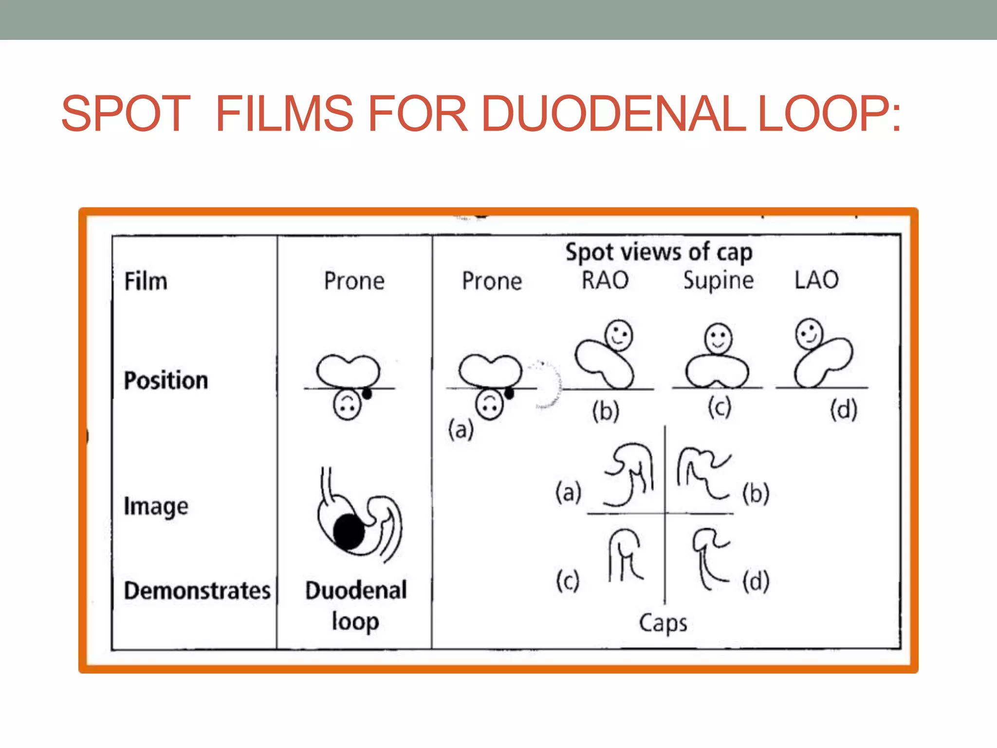 barium studies in gi pathologies | PPTX