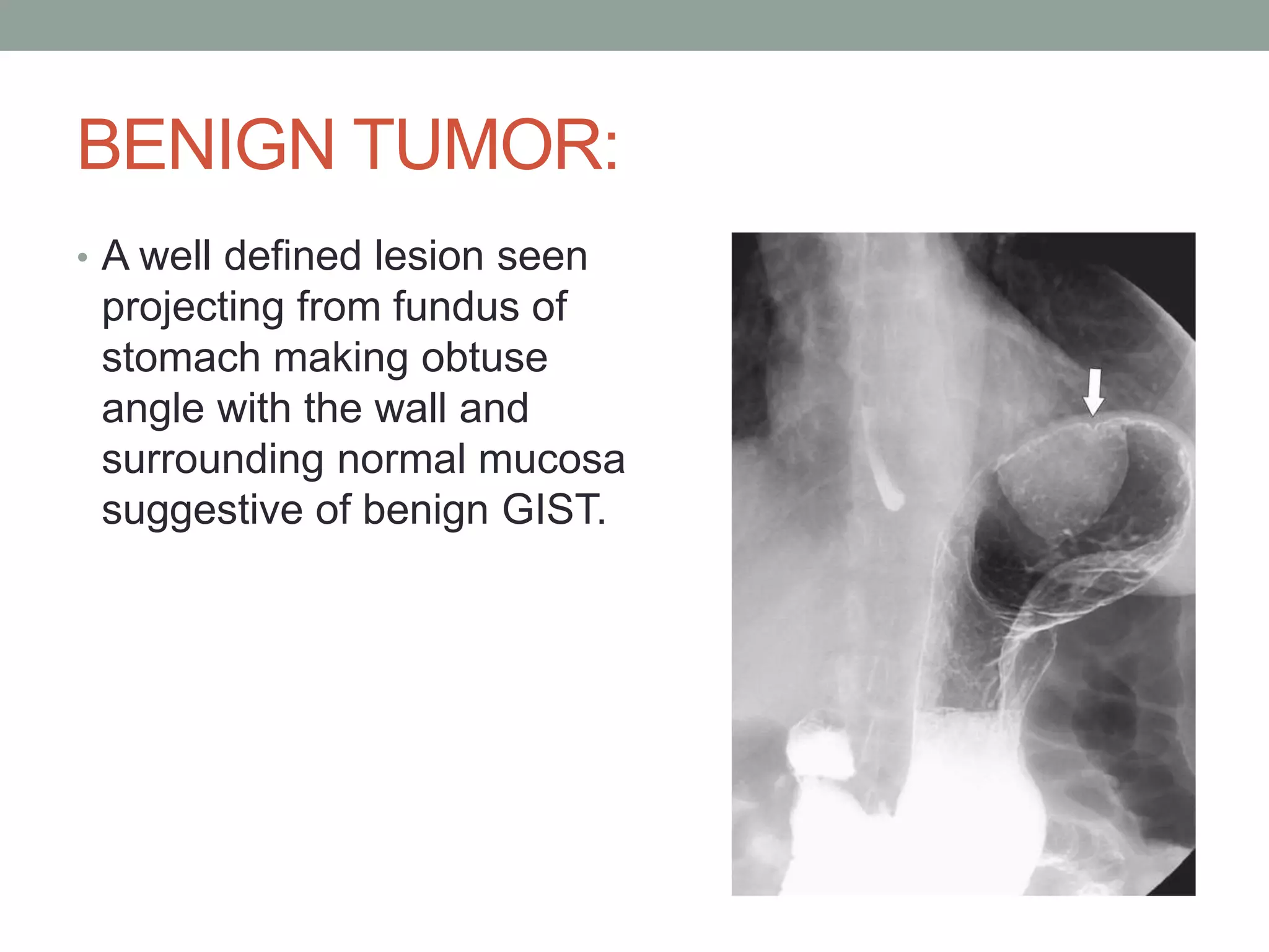 barium studies in gi pathologies | PPTX