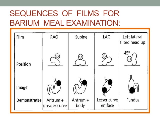 barium studies in gi pathologies | PPTX | Digestive Disorders ...