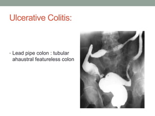barium studies in gi pathologies | PPTX