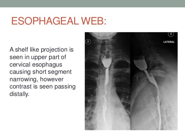 barium studies in gi pathologies