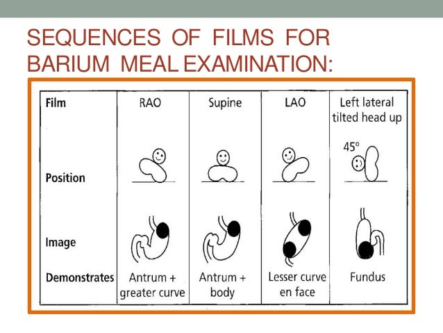 barium studies in gi pathologies