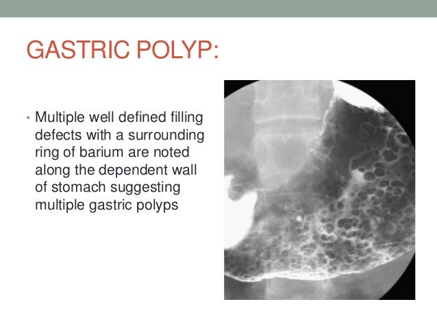 barium studies in gi pathologies