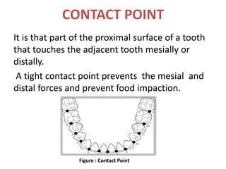 IMPORTANCE OF CONTACT POINT IN RESTORATION_104437.pptx