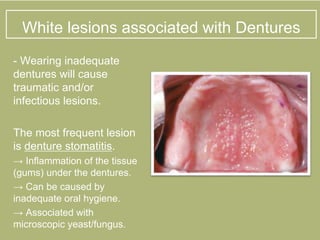 Importance of dental health | PPTX