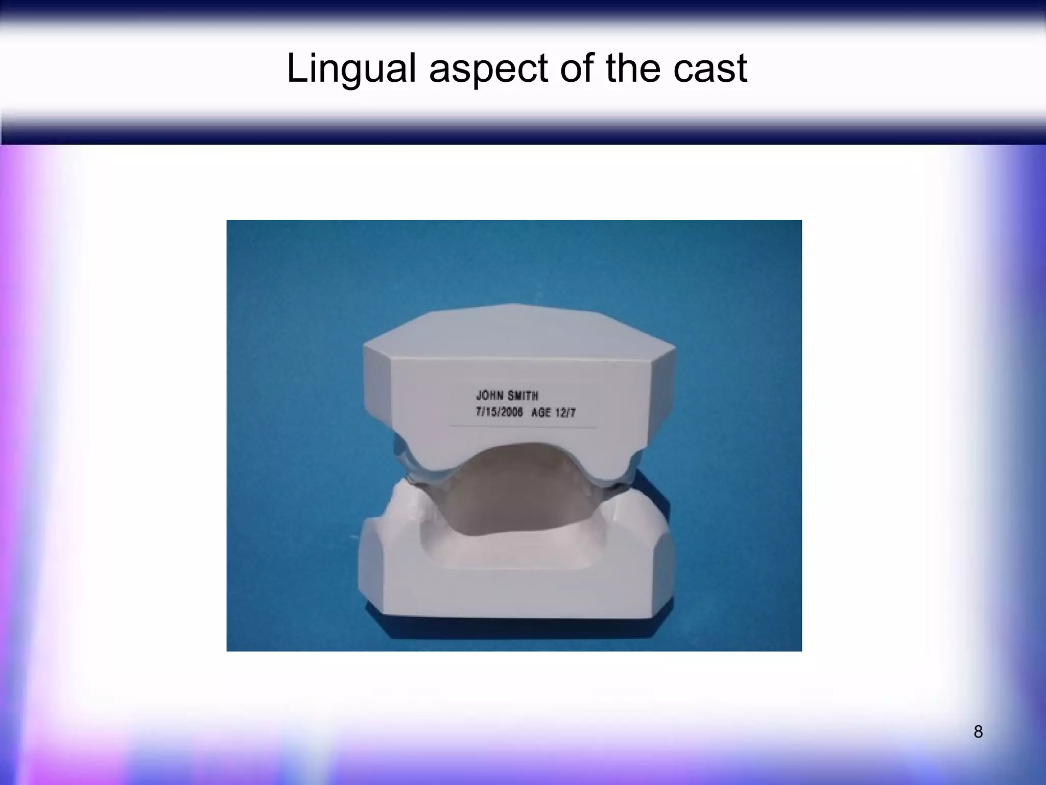 Importance of diagnostic cast in dental implant | PPT