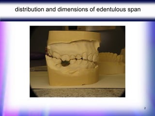 Importance of diagnostic cast in dental implant | PPT