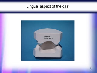 Importance of diagnostic cast in dental implant | PPT