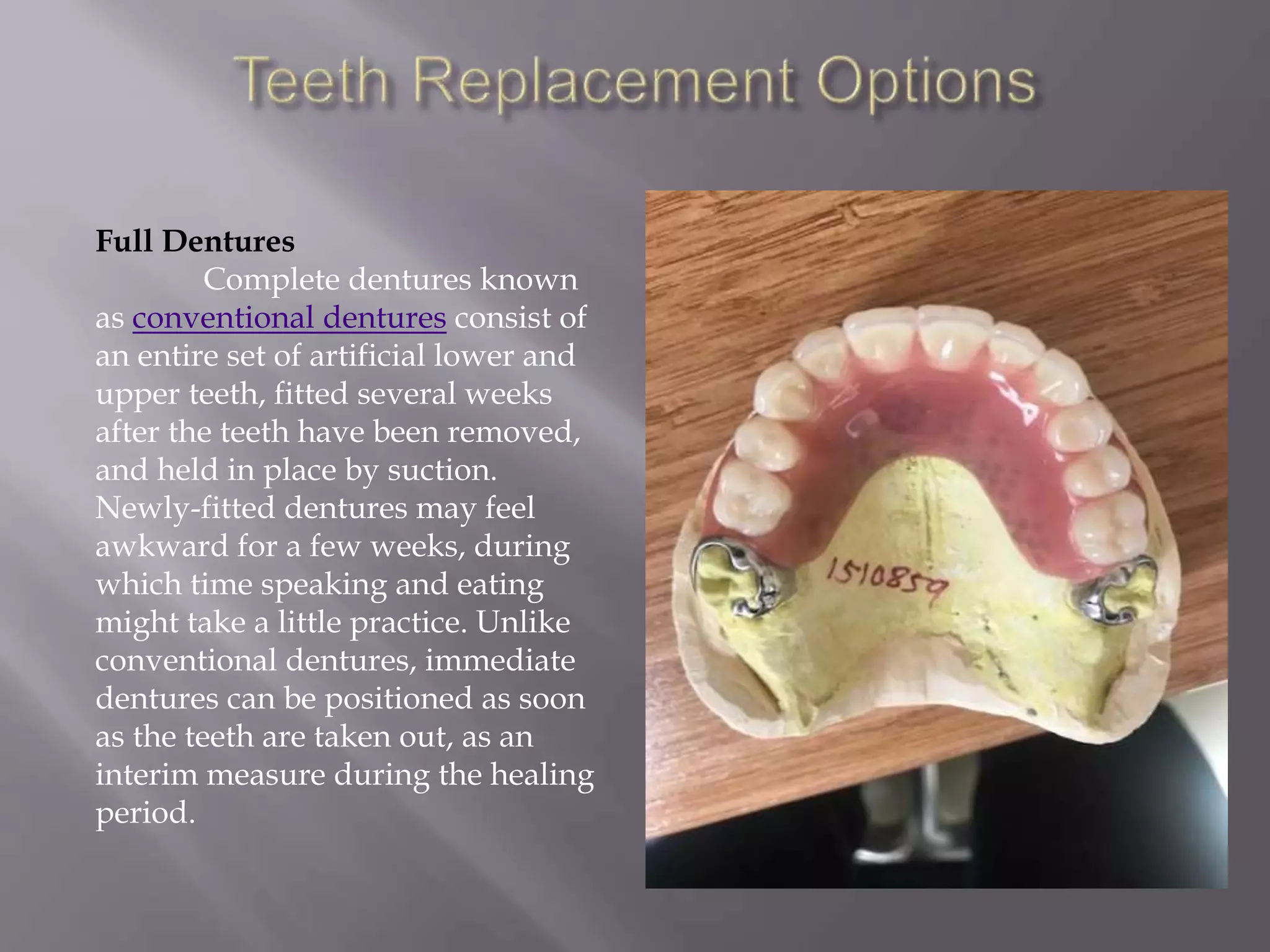 Importance of replacing lost teeth | PPTX