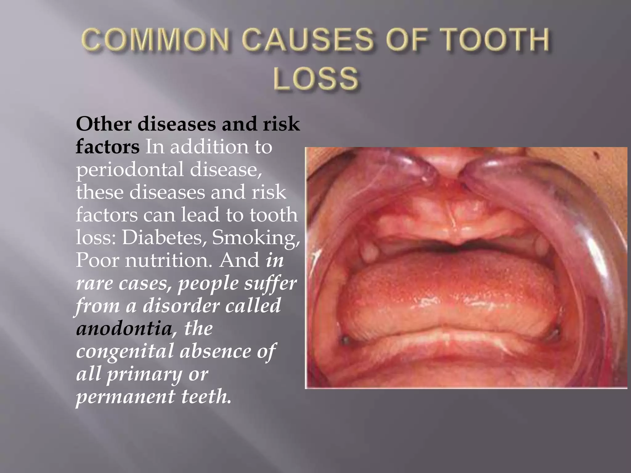 Importance of replacing lost teeth | PPTX