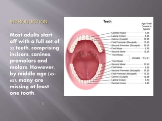 Importance of replacing lost teeth | PPTX