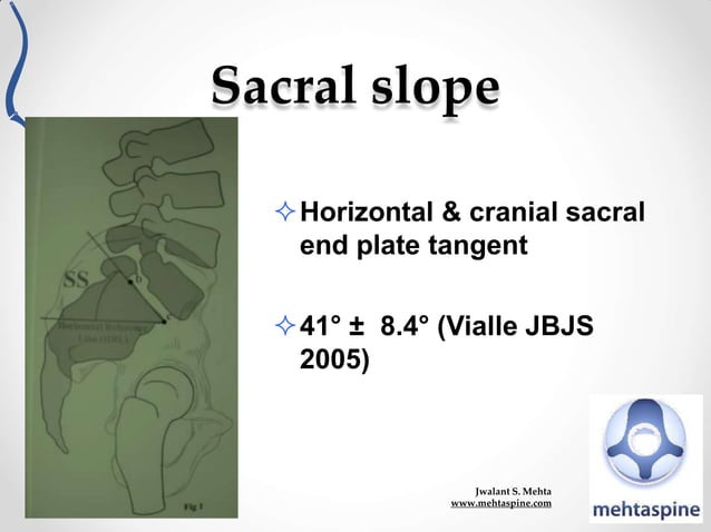 Importance of the sagittal profile in spinal deformity surgery | PPTX ...