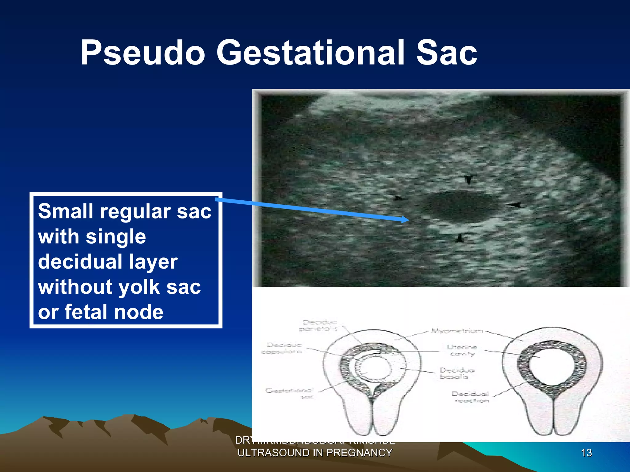 Importance of ultrasound in pregnancy 2 | PPT
