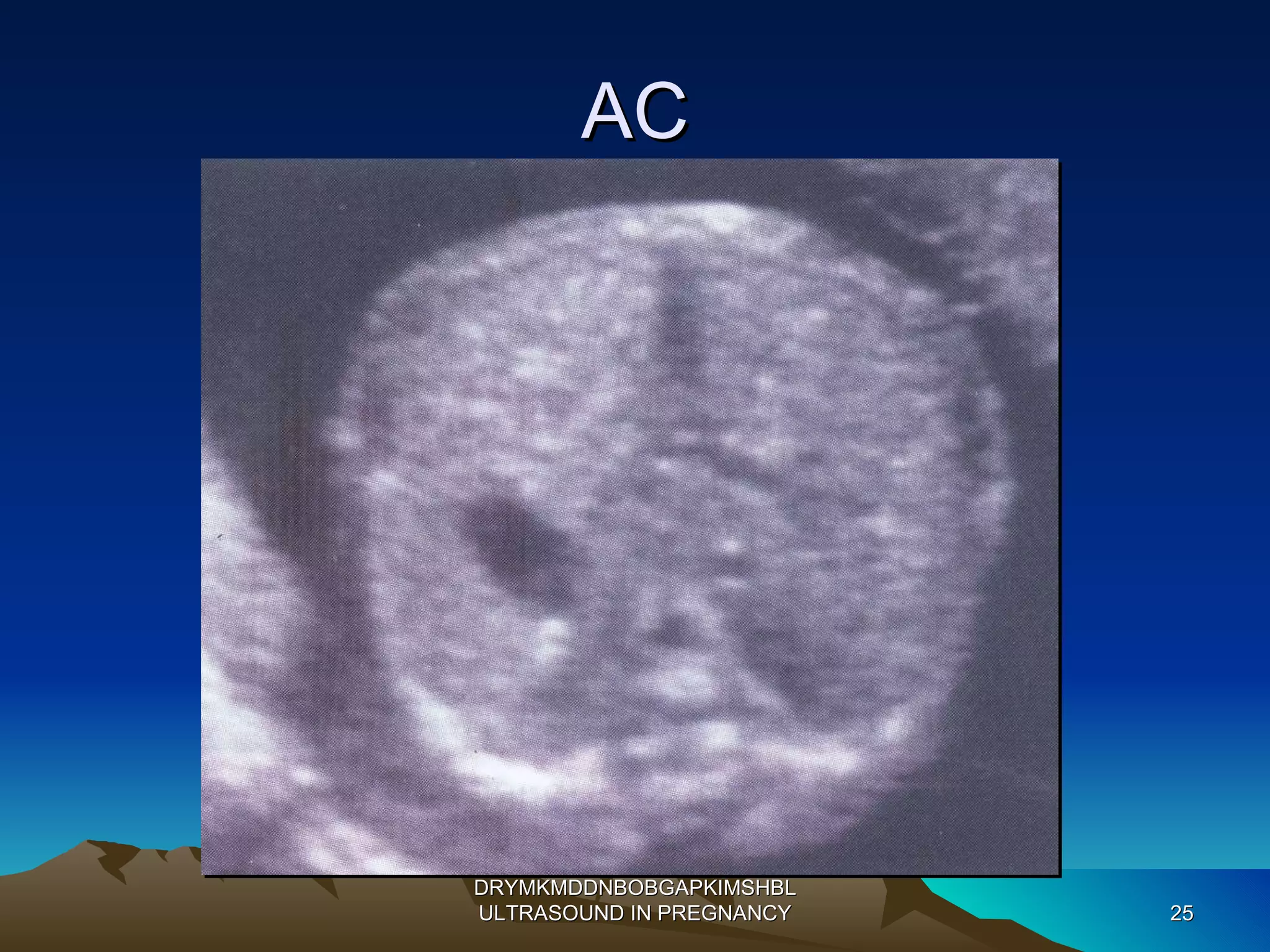 Importance of ultrasound in pregnancy 2 | PPT