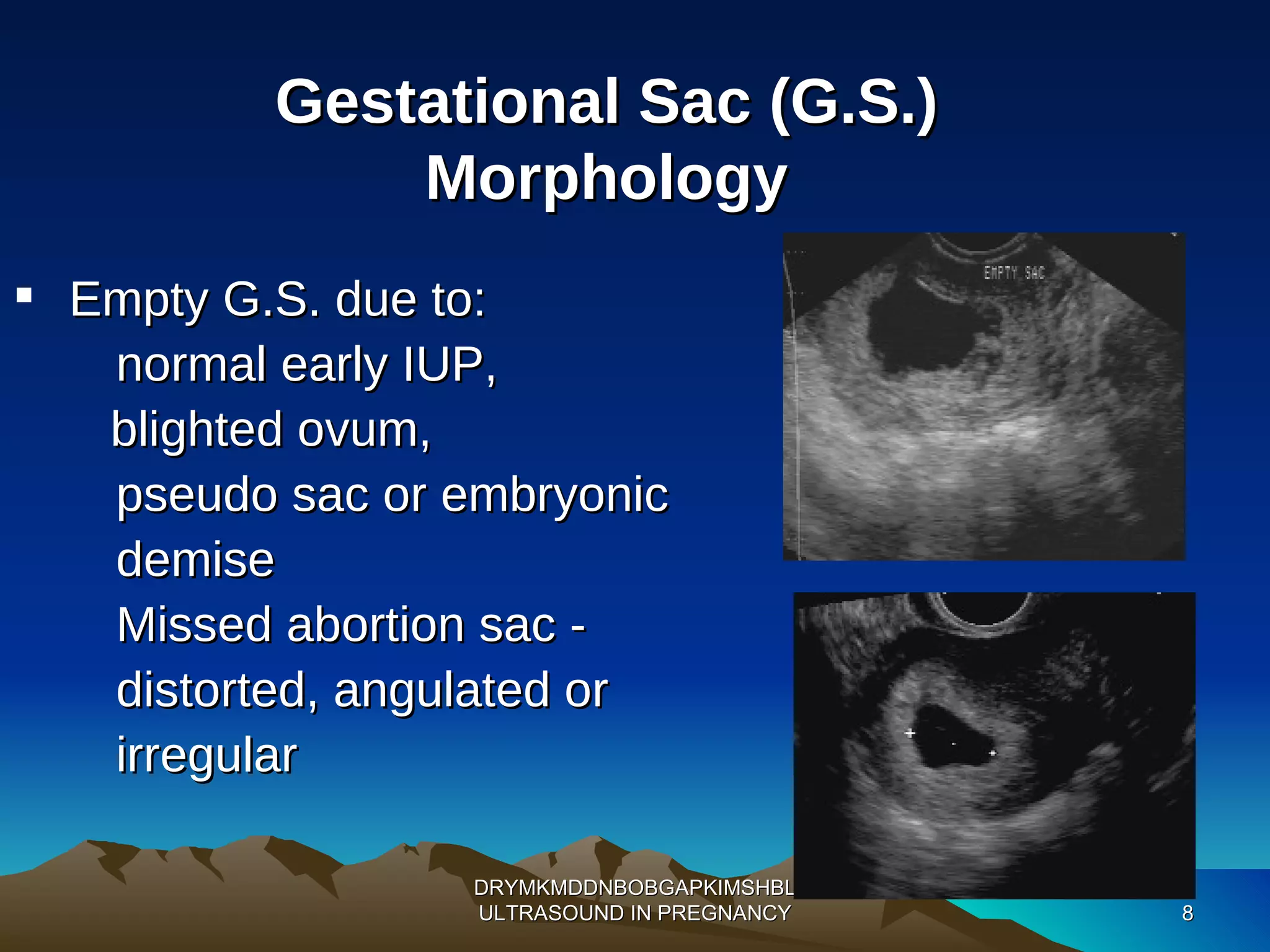Importance of ultrasound in pregnancy 2 | PPT