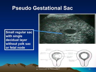 Importance of ultrasound in pregnancy 2 | PPT