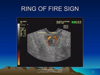 Importance of ultrasound in pregnancy 2 | PPT