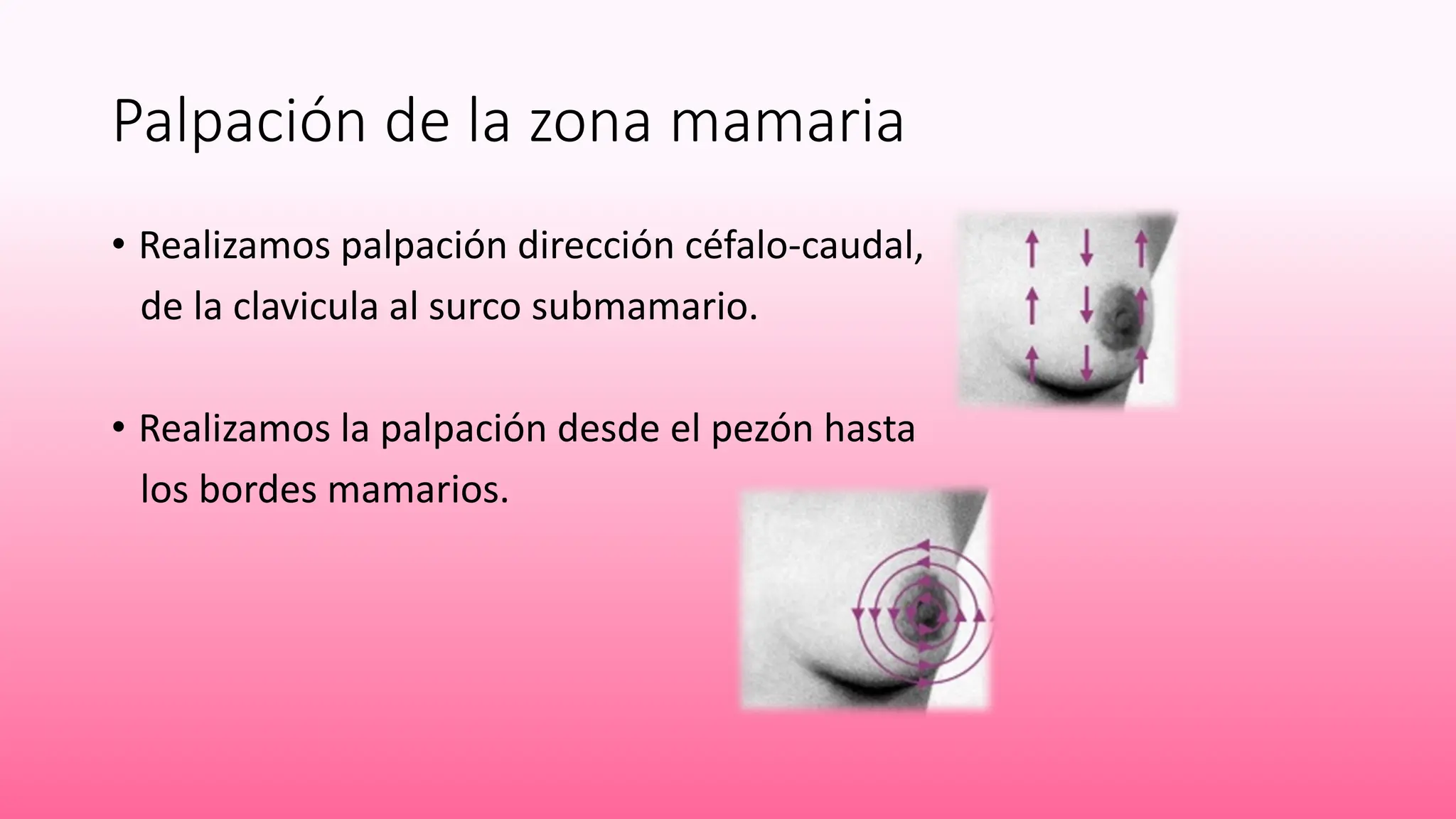 Importancia de la exploración mamaria correcta.pdf