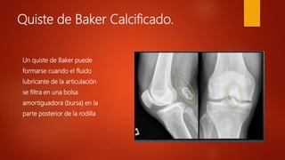IMPORTANCIA DEL RADIODIAGNOSTICO EN FISIOTERAPIA.pptx