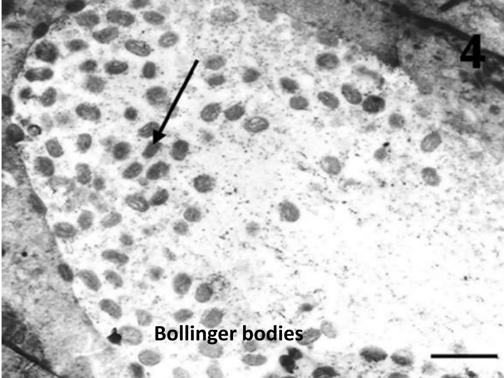 Important bodies in pathology | PPTX