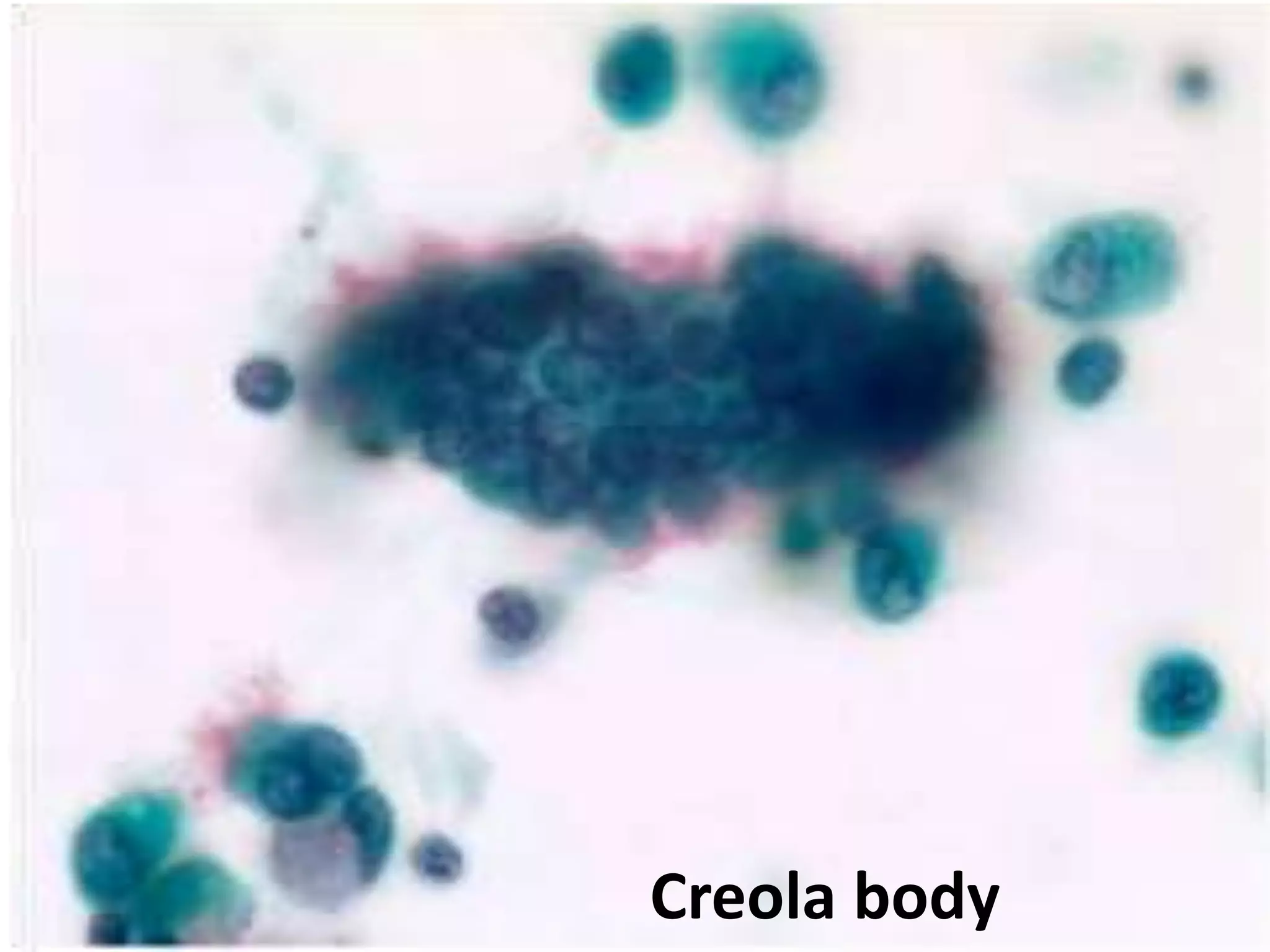 Important bodies in pathology | PPTX