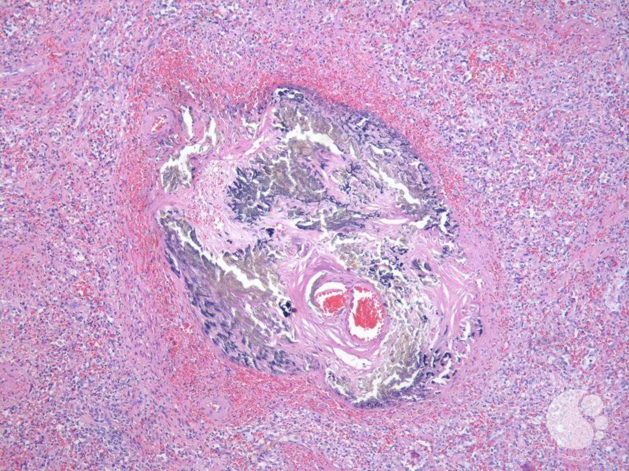 Important bodies in pathology | PPTX
