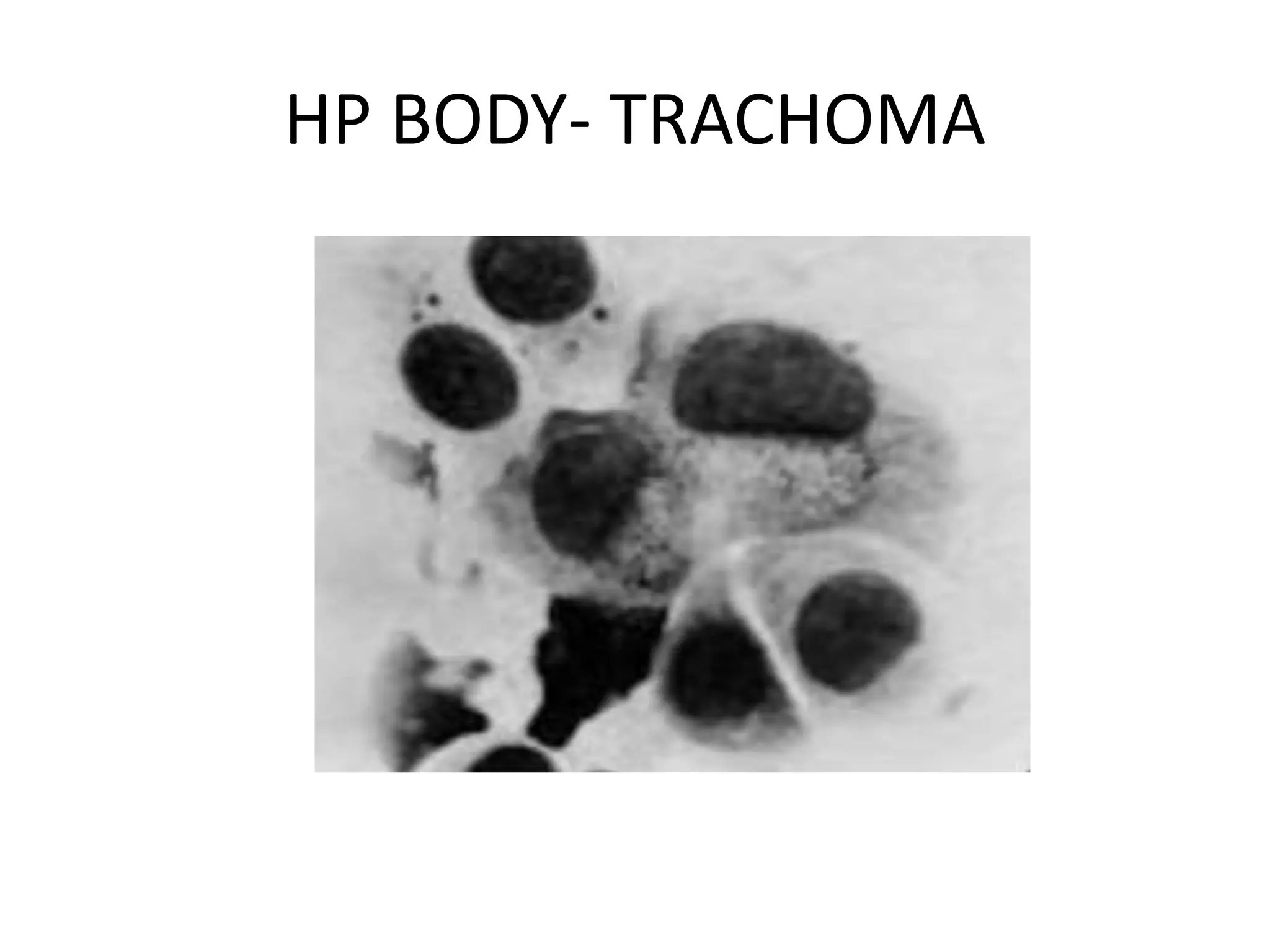 Important bodies in pathology | PPTX