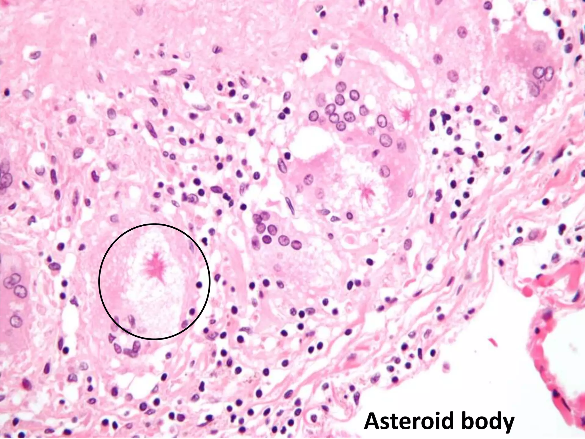 Important bodies in pathology | PPTX